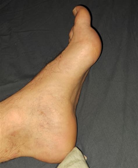 Put Yourself In This Arch Of My Giant Feet Rgiantmalefeet