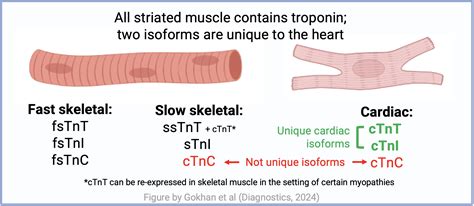 Isoforms Of Troponin Troponin Toolbox