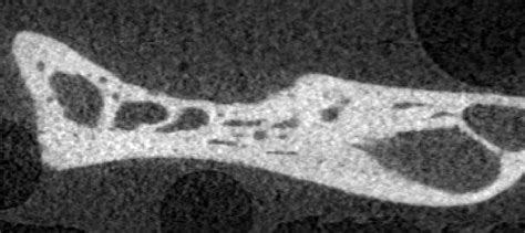 Segmentation Criteria For Using Segmentgeometry To Calculate 2nd