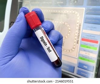 Blood Sample Digoxin Test Digoxin Medicine Stock Photo 2146019551 Shutterstock