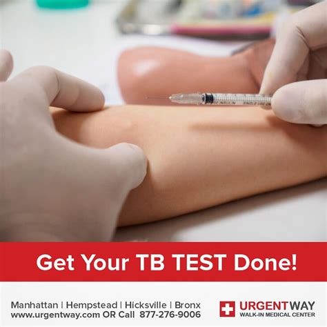 Tb Test Get Your Tb Test Done Ppd Tb Skin Test Made Eas Flickr