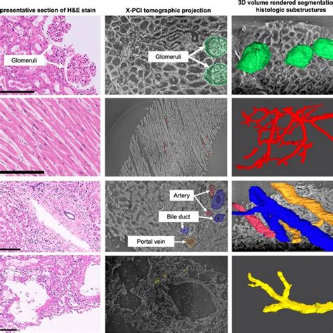 Setup For Synchrotron Based X Ray Phase Contrast Imaging Of