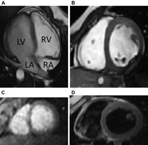 Cardiac Magnetic Resonance Imaging Download Scientific Diagram