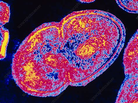 Coloured Tem Of Enterococcus Faecalis Stock Image B236 0053 Science Photo Library