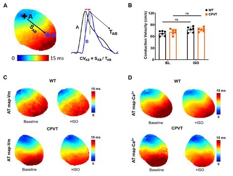 Dual Dye Optical Mapping Of Hearts From Ryr2r2474s Knock In Mice Of
