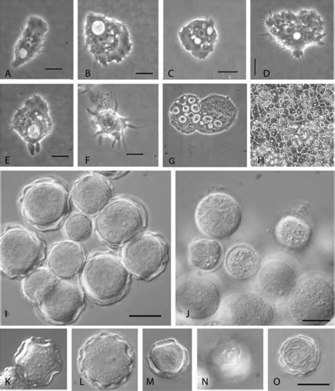 Acanthamoeba Trophozoite