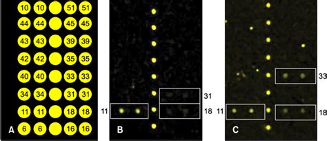 The Hpv Dna Chip Was Amplified From The Human Papillomavirus Hpv Download Scientific Diagram