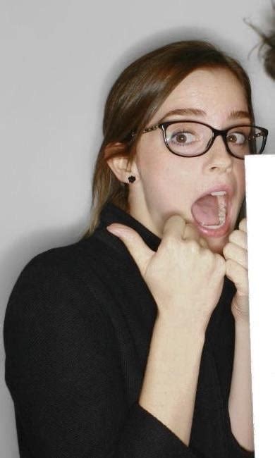 Emma Watson Teeth And Mouth Rcelebritymouths