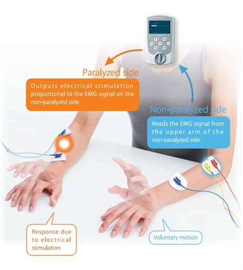 Handheld Functional Electrical Stimulator Fes Model Namenumber Gd 611 At Best Price In Bengaluru