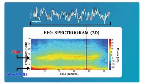 مقدمه‌ای بر Eeg Spectrogram طیف نگاری سیگنال Eeg آکادمی آنلاین