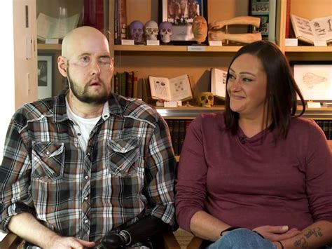 Man Receives Worlds First Eye Transplant Engoo Daily News