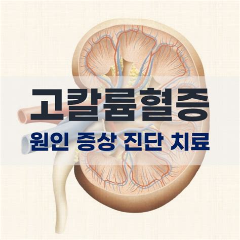 고칼륨혈증 원인과 증상 치료 Hyperkalemia 네이버 블로그