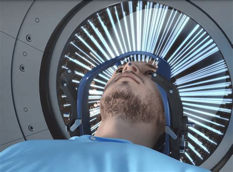 Leksell Vantage Transforming Gamma Knife Radiosurgery