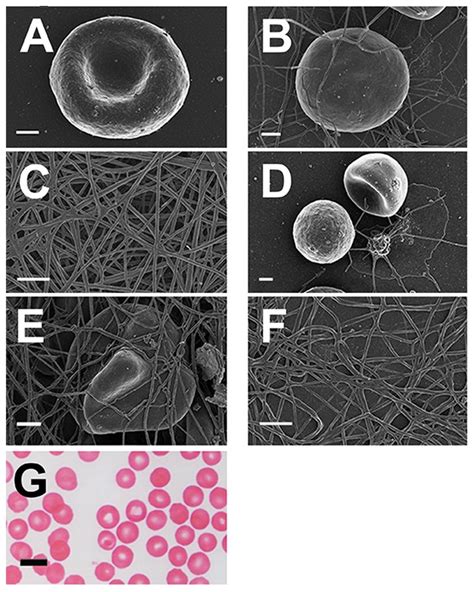 All Sem Micrographs Scales 1 µm Light Microscopy Micrograph Scale