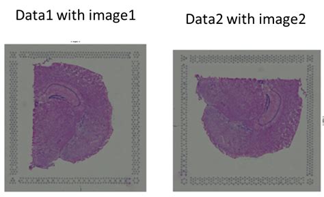 Mnn Correction On Spatial Datasets · Issue 570 · Scversesquidpy · Github