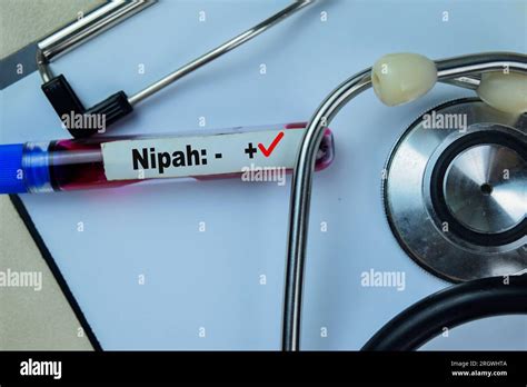 Nipah Test With Blood Sample Top View Isolated On Office Desk Healthcare Or Medical Concept