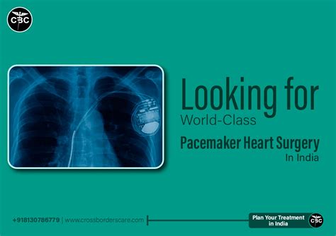 Aicd Implantation In India Cardiac Arrhythmia Treatment Cost