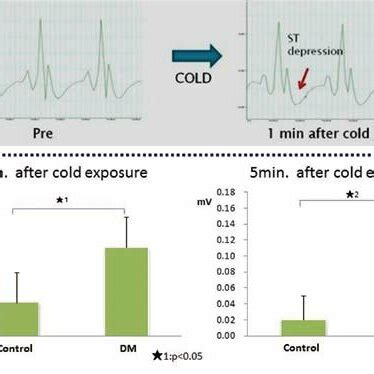 Changes Of ST Segment In ECG Changes Between ST Segments Before And Download Scientific