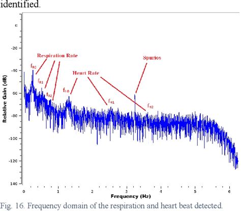 Figure 16 From High Gain Patch Antenna Array For Biomedical Applications Semantic Scholar