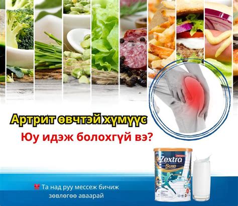 Zextra Үе мөчний өвчтэй хүмүүс юу идэж болохгүй вэ Үе мөчний