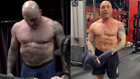 Joe Rogan Vitiligo