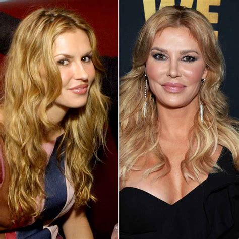Real Housewives Plastic Surgery Before And After Photos