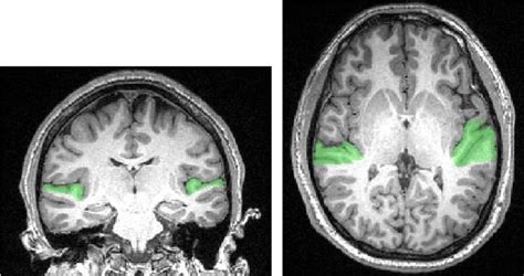 Cross Modal Multivariate Pattern Analysis