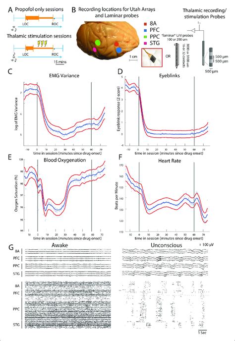 Propofol Anesthesia Paradigm And Physiological Indices Of Loc A