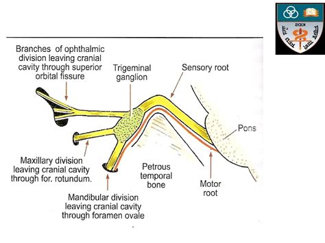 Signs Symptoms And Treatment Of Trigeminal Neuralgia Pptx Dental Health Diseases And