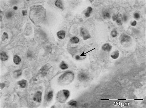 Intestine Inclusion Bodies Arrow He × 100 Download Scientific