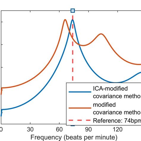 An Overview Of Heart Rate Radar Monitoring System Download Scientific Diagram