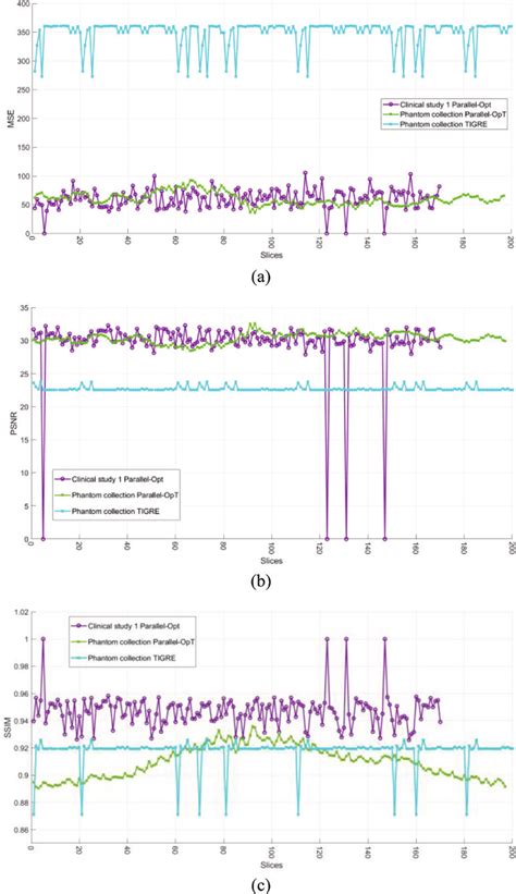 Mse Psnr And Ssim Image Quality Parameters Vs Slices A Mse B Download Scientific Diagram