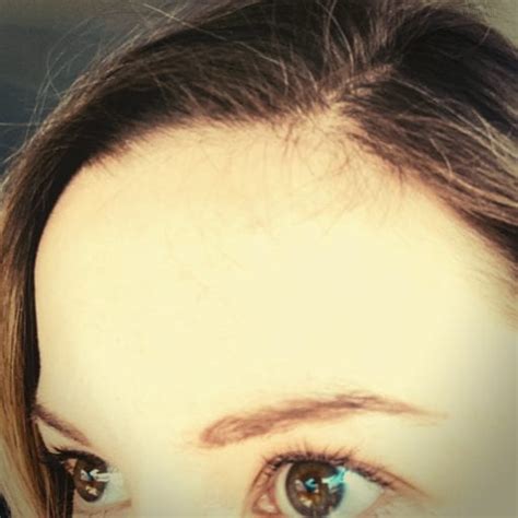 Got Scalp Build Up Try This Scalp Exfoliation Diy And Scalp Brush