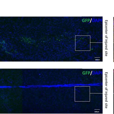 Ccr5 Protein Structure Protein Structure Of Ccr5 Indicating Regions Of Download Scientific