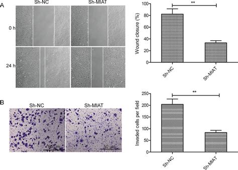 Knockdown Of Miat Inhibits Cell Migration And Invasion In Ptc Cells