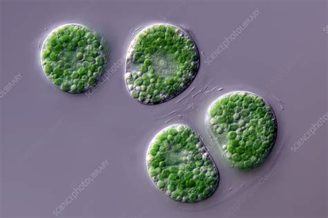 Cyanoptyche Algae Light Micrograph Stock Image C057 7480 Science Photo Library