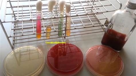 Salmonella Typhi Growth On Nutrient Agar Archives Medical Notes Hot Sex Picture