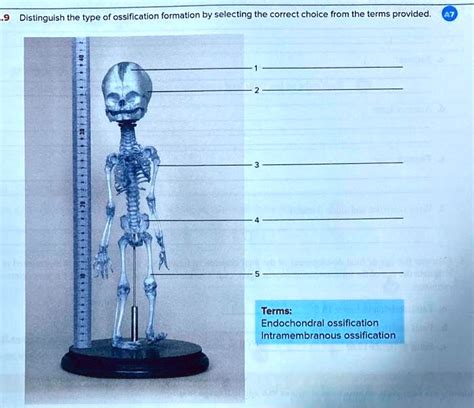 Solved Distinguish The Type Of Ossification Formation By Selecting The Correct Choice From The