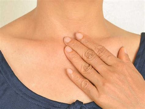Rash On My Neck And Chest Poikiloderma Of Civatte Causes Symptoms