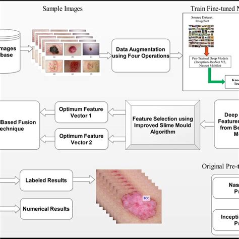 Proposed Framework For Multiclass Skin Lesion Classification Download Scientific Diagram