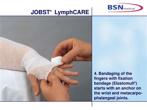 Compression Bandaging For The Arm With Lymphoedema Ppt Download