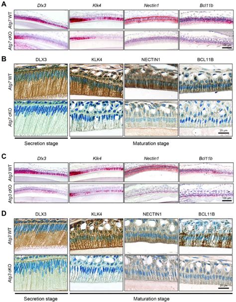 Autophagy Plays A Crucial Role In Ameloblast Differentiation Pmc