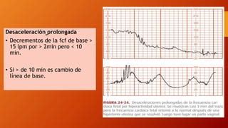 Monitoreofetalintraparto Mi Erazpptx