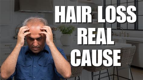 Is Masturbation Making You Bald The Truth No One Talks About Youtube