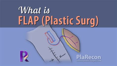 Flap In Plastic Surgery