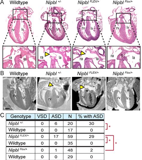 Nipbl Flex And Nipbl Mice Develop Heart Defects At The Same High