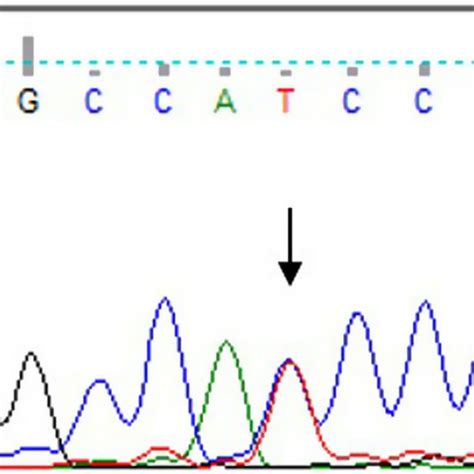 Chromatogram Of A Part Of The Dna Sequence From An Individual
