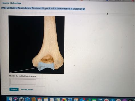 Solved PB Appendicular Skeleton Upper Limb Lab Practical Chegg