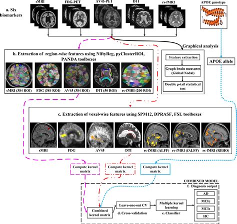 Frontiers Classification And Graphical Analysis Of Alzheimers Disease And Its Prodromal Stage