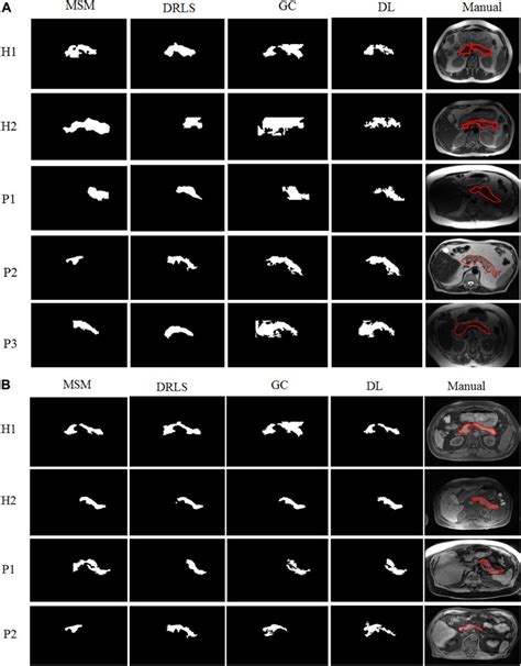 Segmentation Comparison For Different Imaging Techniques Automated Download Scientific Diagram